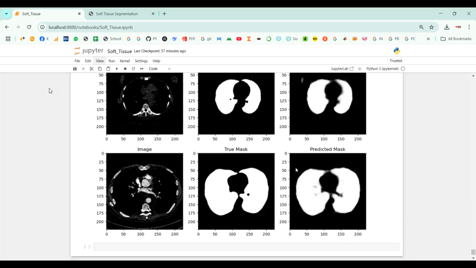 Soft Tissue Segmentation using Image Dataset in Python Projects