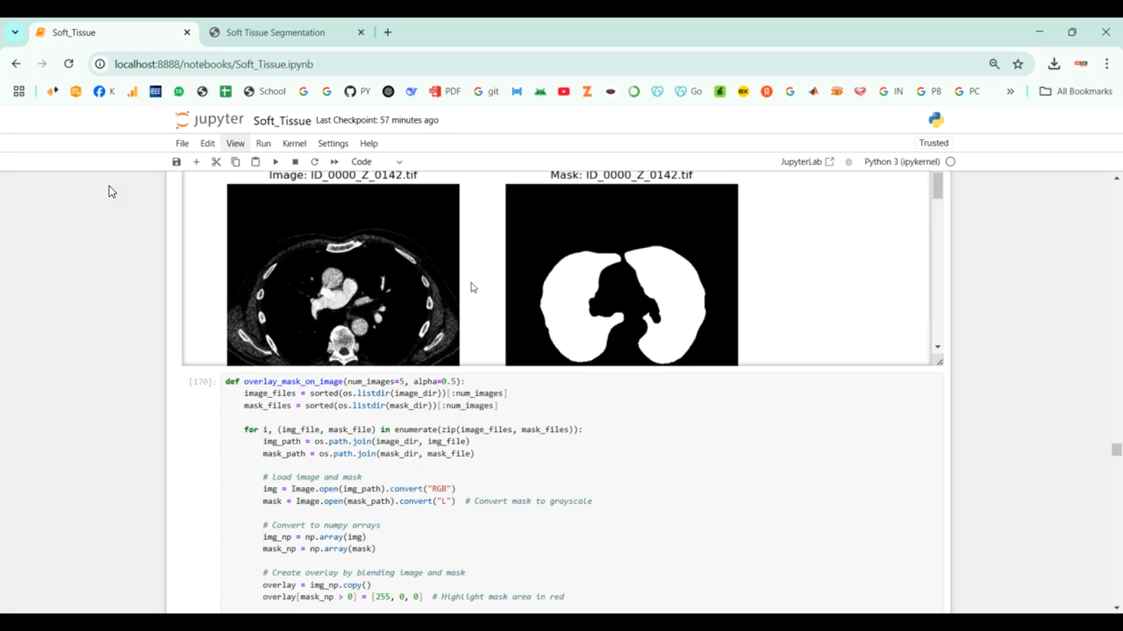 Soft Tissue Segmentation using Image Dataset in Python Projects